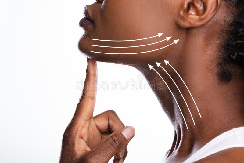 Woman Face Neck Lift stock image. Image of african, lift - 189290331