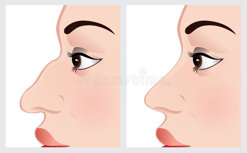 Bandage Cartoon Stock Illustrations – 9,844 Bandage Cartoon Stock ...