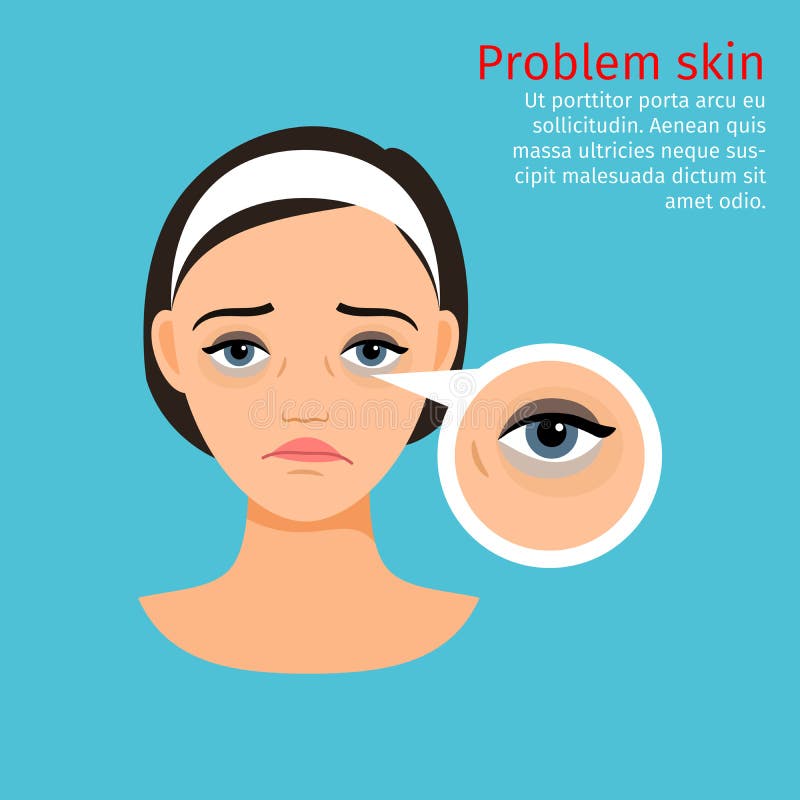 Woman Face Problem Eye Black Circles Stock Vector - Illustration of ...