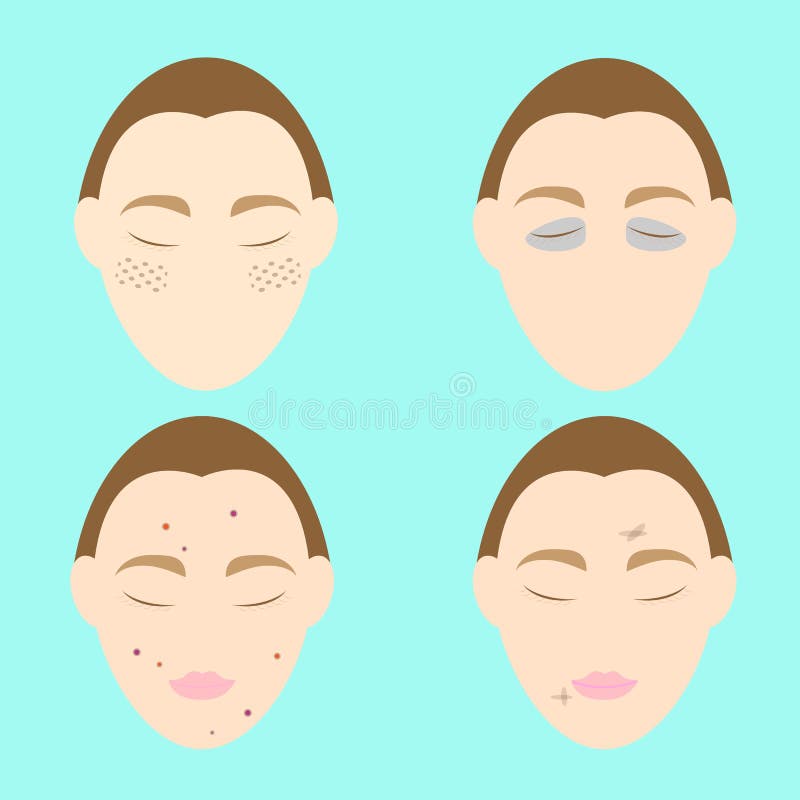 Woman Face Problems on Blue Background Stock Vector - Illustration of ...