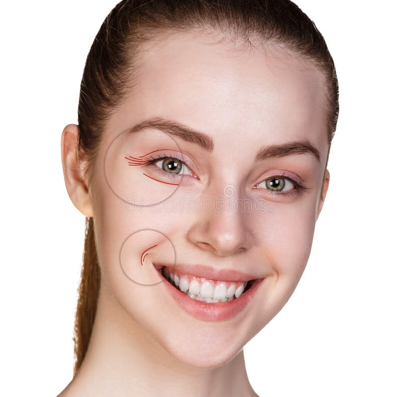 Woman Face Shows Age-related Mimic Wrincles. Stock Photo - Image of ...