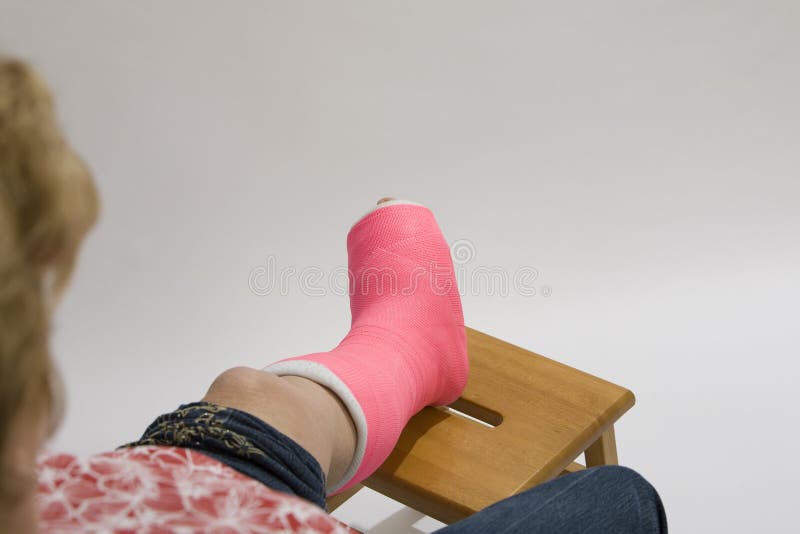 747 Woman Foot Cast Stock Photos - Free & Royalty-Free Stock Photos ...