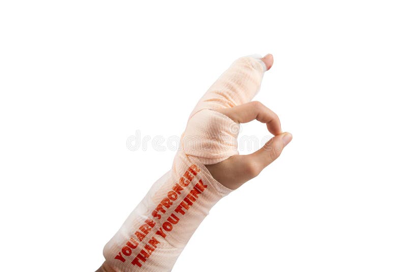 Woman Hand Bone Broken from Accident Emergency Concept Stock Image ...