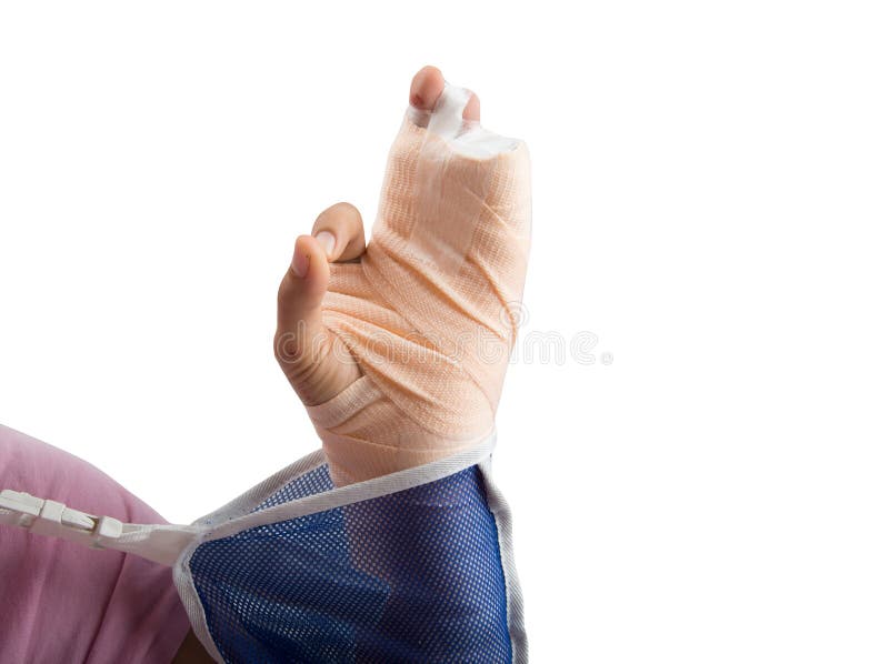 Woman Hand Bone Broken Makehand Sign Ok Isolate Stock Image - Image of ...