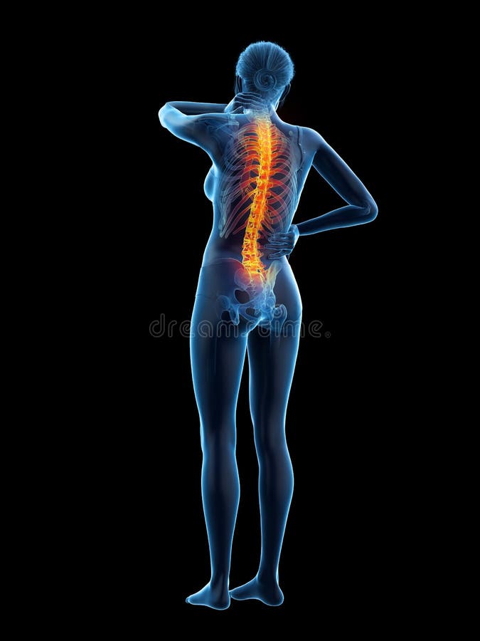 A woman having a backache stock illustration. Illustration of arthritis ...