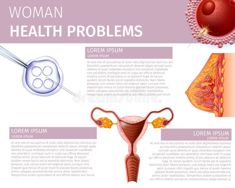 Uterus Front View Stock Illustrations 65 Uterus Front View Stock