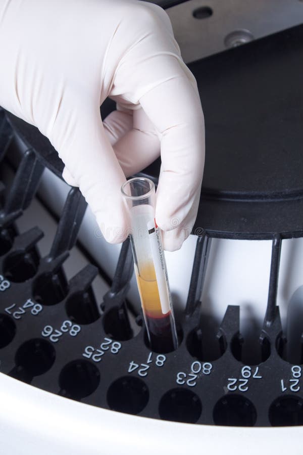 Woman Loading Samples in Analyzer Stock Image - Image of analysis ...