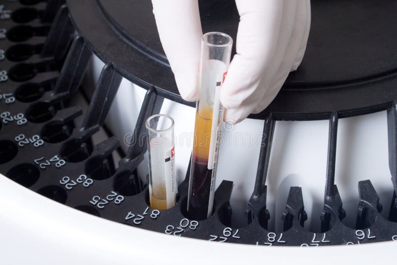 Woman Loading Samples in Analyzer Stock Photo - Image of health ...