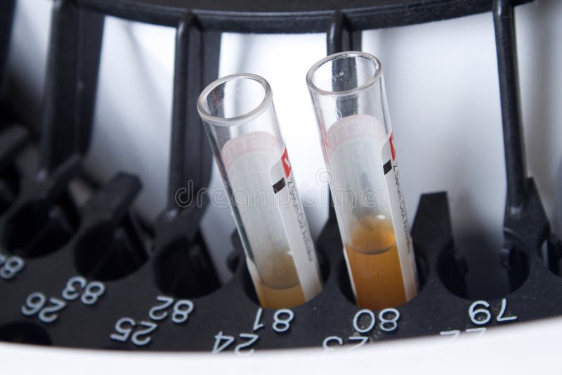 Woman Loading Samples in Analyzer Stock Image - Image of pharmacy ...