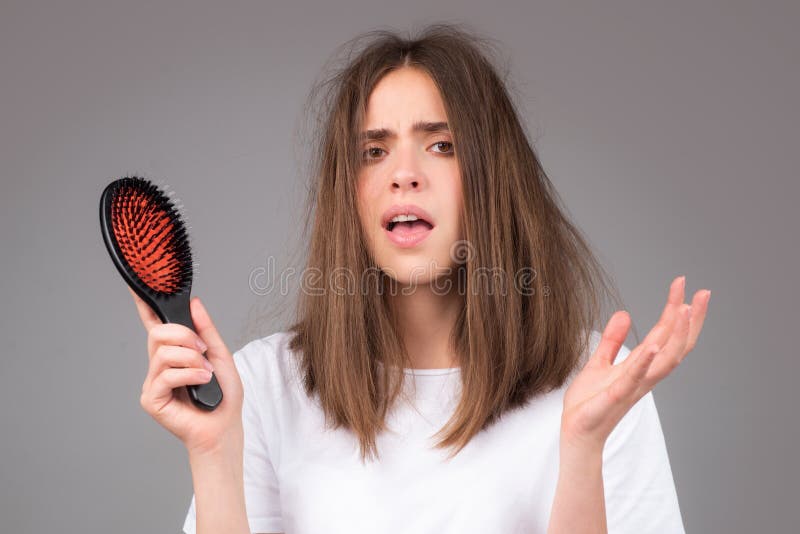 Woman Loosing Hair. Hair Loss Problem, Baldness. Stock Photo - Image of ...