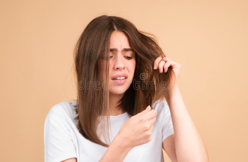 Woman Loosing Hair. Hair Loss Problem, Baldness. Stock Photo - Image of ...