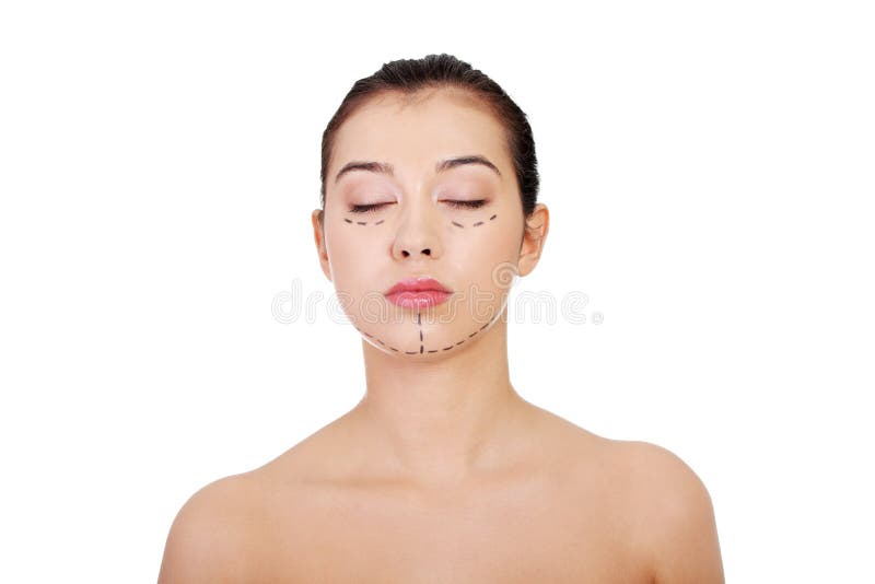 Woman Marked Out Fo Rcosmetic Surgery. Stock Photo - Image of mark ...
