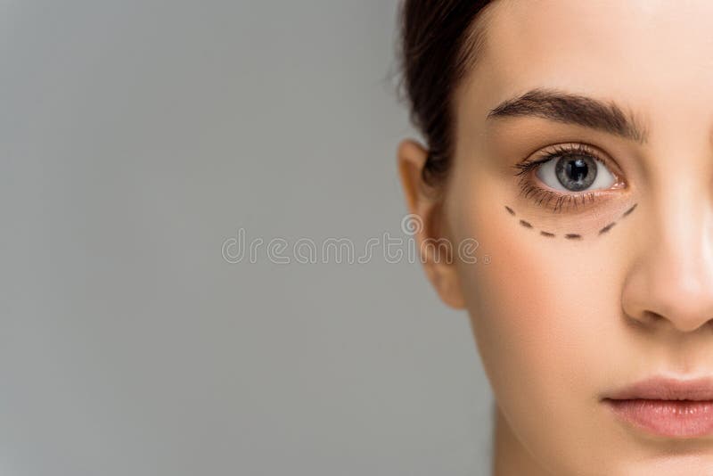 Woman with Marks on Face Looking at Camera Isolated on Grey Stock Photo ...