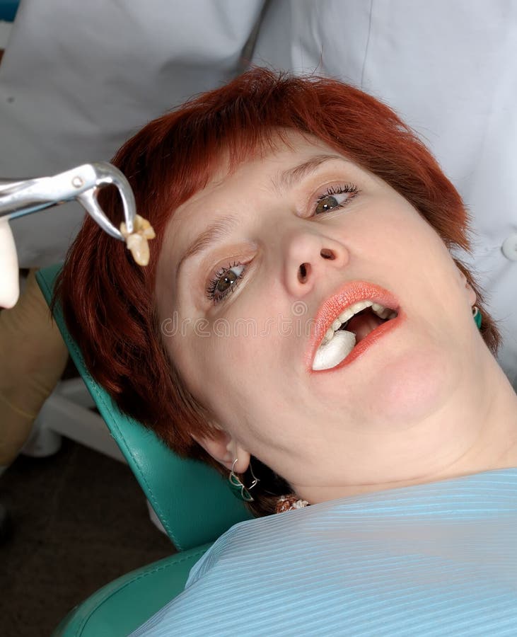 Hangover Image Of Tooth Extraction