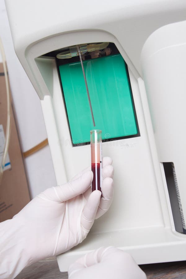 Woman Performin Hematological Test. Stock Image - Image of equipment ...