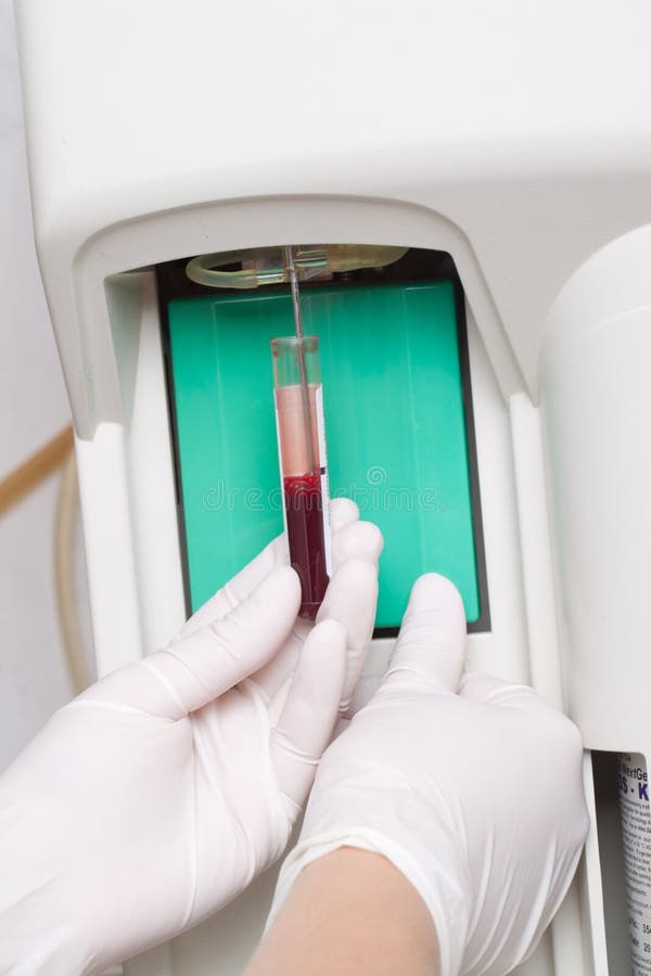 Woman Performin Hematological Test. Stock Photo - Image of concept ...