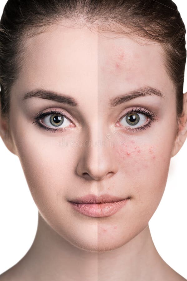 15,206 Problem Skincare Stock Photos - Free & Royalty-Free Stock Photos ...