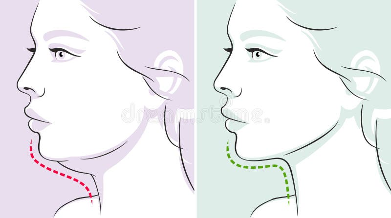 Chin Stock Illustrations – 7,498 Chin Stock Illustrations, Vectors ...
