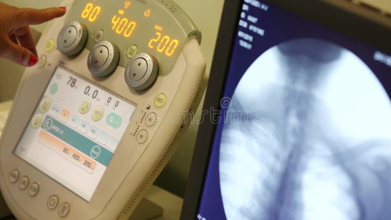 Woman Puts a Finger on the Control Panel X-ray Stock Video - Video of ...