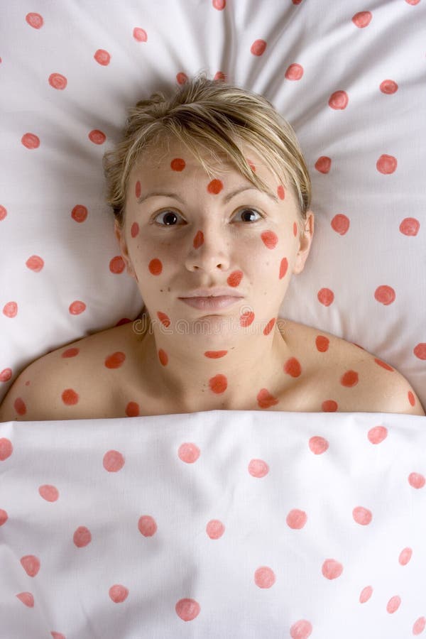 Woman With Red Spots On Face And Body Stock Image Image Of Bedroom Sick 892785