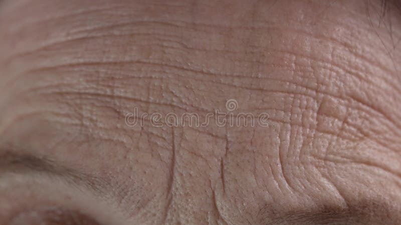 Woman S Forehead with Deep Wrinkles Stock Footage - Video of facial ...