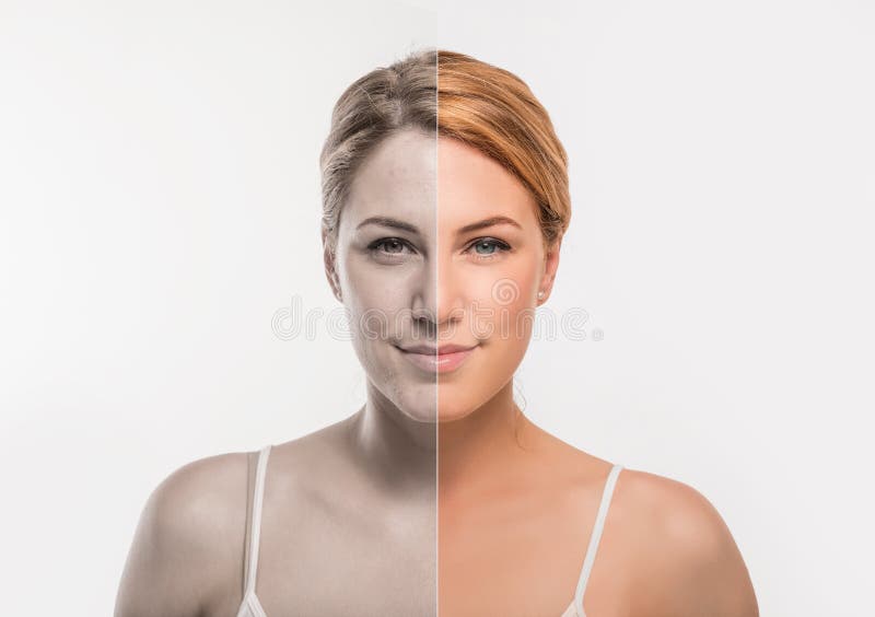A Woman`s Portrait with Retouched and without Retouching is Divided ...