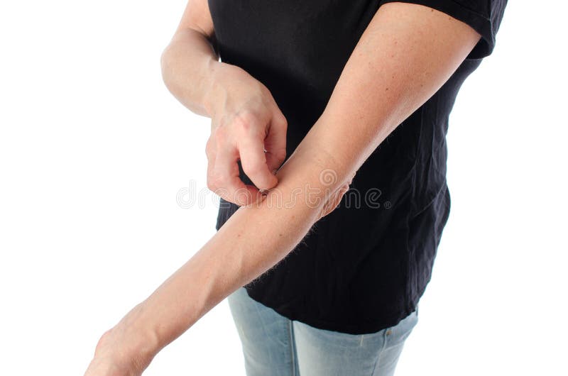Woman scratching her arm stock image. Image of treatment - 47136273