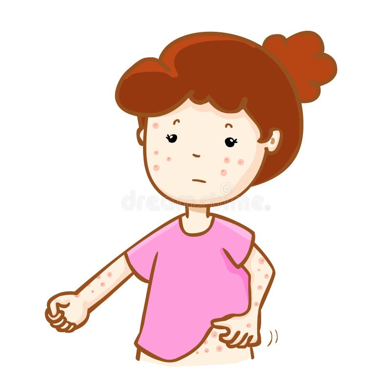 Rash Infection Stock Illustrations – 4,186 Rash Infection Stock ...