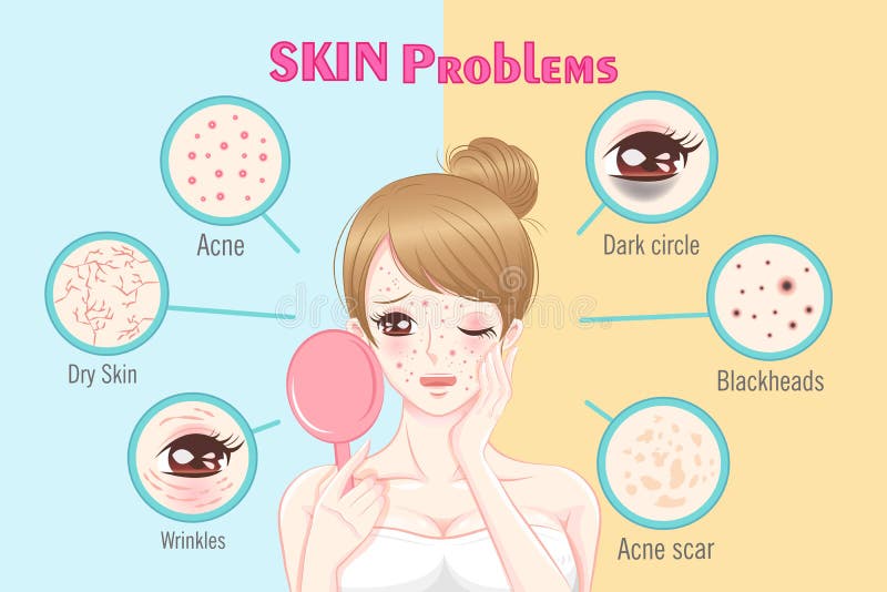 Woman with skin problem stock vector. Illustration of mirror - 111897027