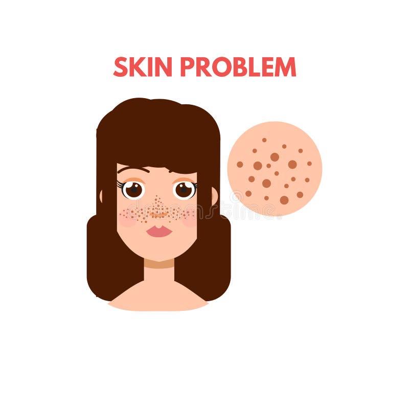 Woman with Skin Problem. Vector Stock Vector - Illustration of human ...