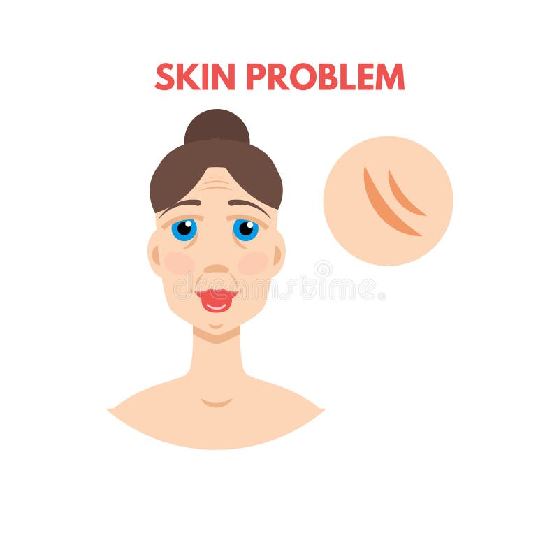Woman with Skin Problem. Vector Stock Vector - Illustration of acne ...