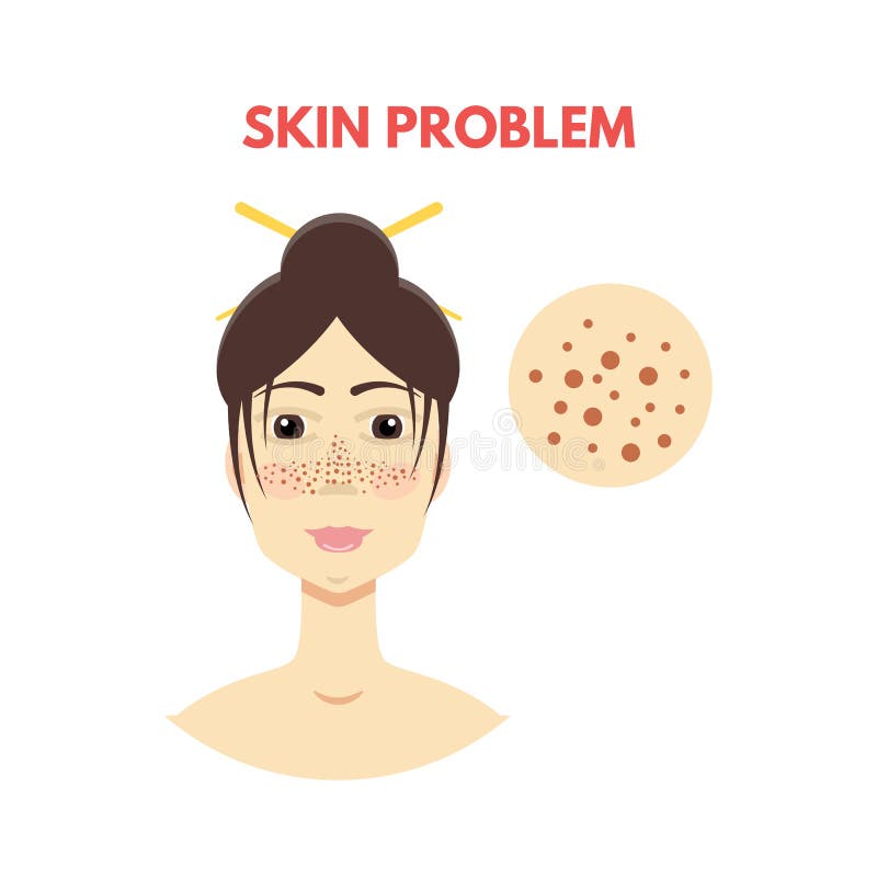 Woman with Skin Problem. Vector Stock Vector - Illustration of ...