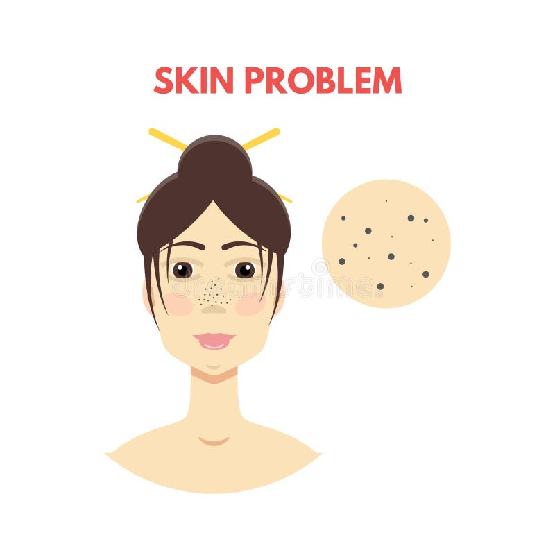 Woman with Skin Problem. Vector Stock Vector - Illustration of face ...