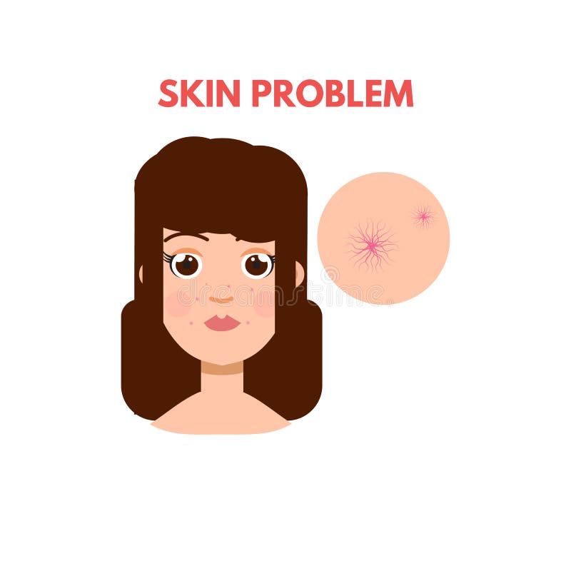 Woman with Skin Problem. Vector Stock Vector - Illustration of closeup ...