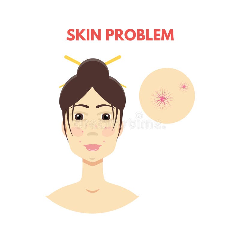 Woman with skin problem. stock vector. Illustration of care - 121733856