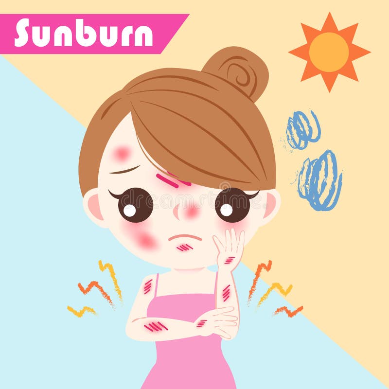 Sunburn Stock Illustrations – 3,095 Sunburn Stock Illustrations ...