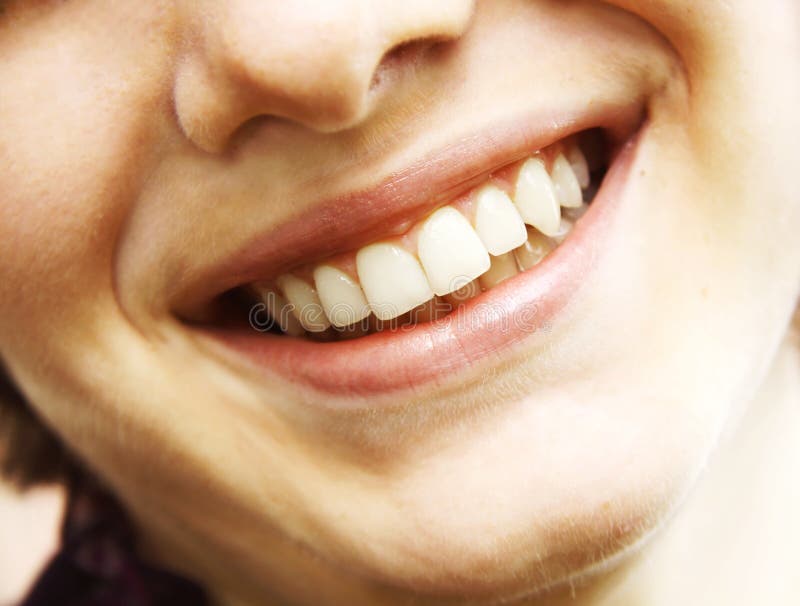 Crooked teeth stock image. Image of ugly, oral, female - 30729373