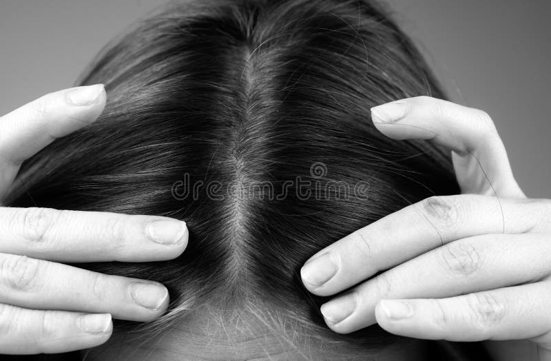 Woman Worried about Hair Loss. Hair Fall Problem. Stock Image - Image ...