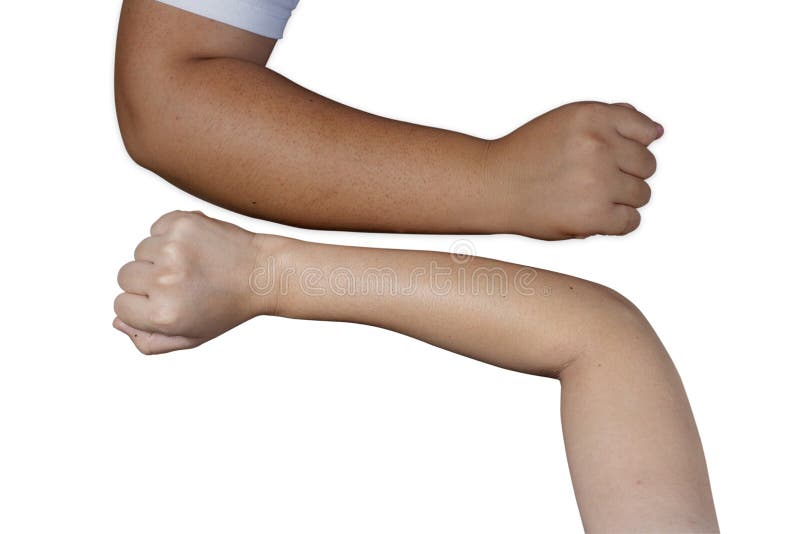 115 Arms Different Skin Color Photos - Free & Royalty-Free Stock Photos ...