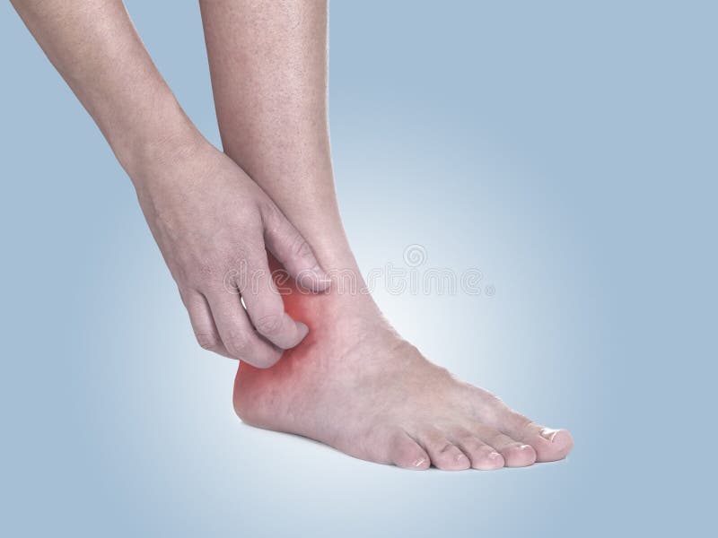 Women Scratch Itchy Ankle Hand Stock Photos - Free & Royalty-Free Stock ...