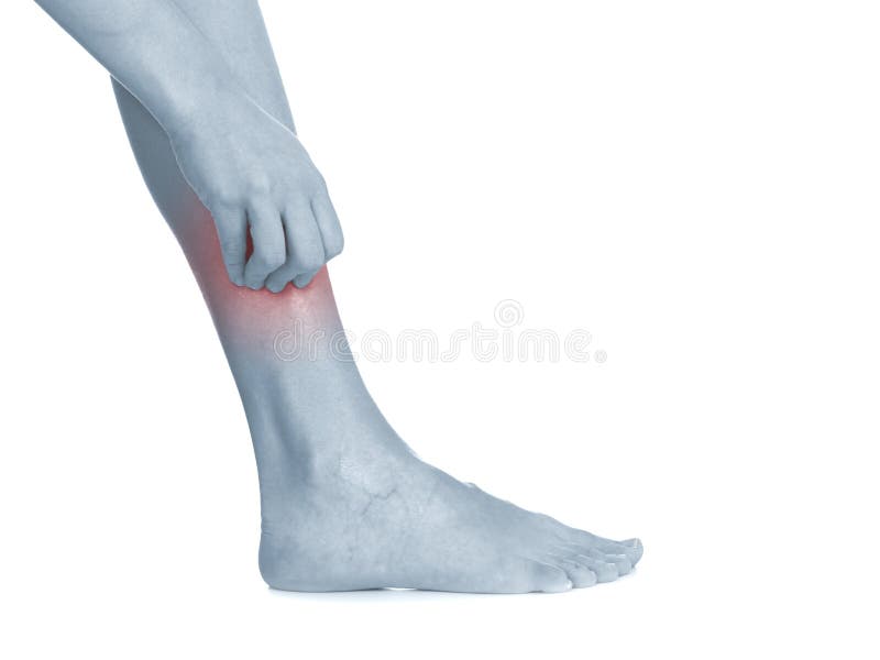 Women Scratch Itchy Ankle with Hand. Stock Image - Image of sore, ankle ...