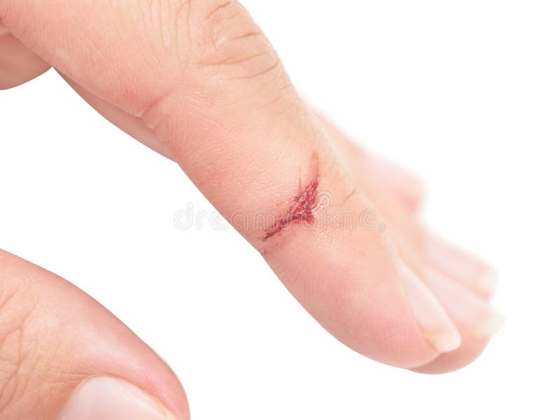 Wond met bloed stock afbeelding. Image of wond, macro - 32413361