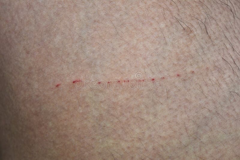 Wond Van Het Krassen Van Kat Stock Afbeelding - Image of gekwetst, dier ...