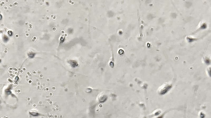 View At Human Sperm Under Microscope In Lab Stock Video Video Of