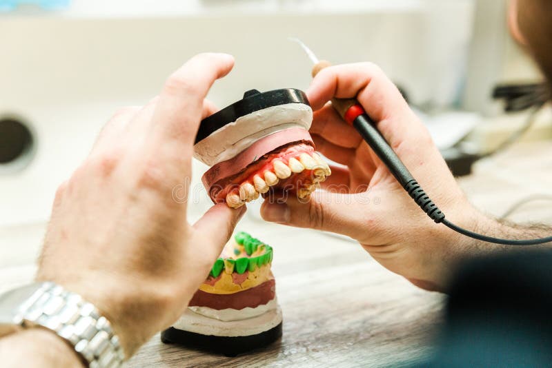 Detailed Dental Model Work in Progress Stock Image - Image of mold ...