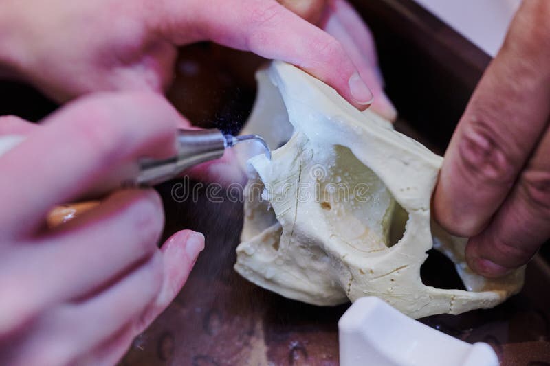 Work with a Piezo Instrument in the Educational Process of Bone ...