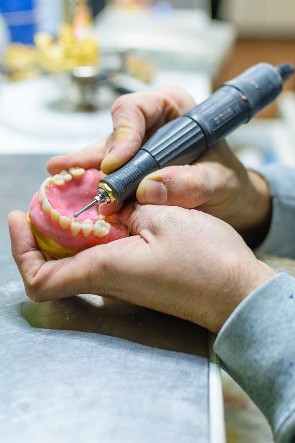 Working with a Drill in a Dental Prosthesis Stock Photo - Image of ...