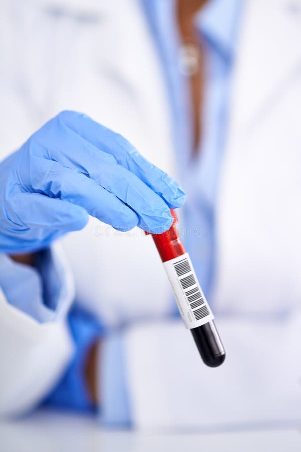 Working for a Healthier Humanity. a Scientist Working with Blood ...