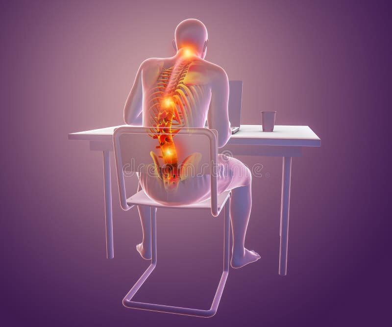 Working with Laptop in a Wrong Position. Concept of Backache, Back Pain ...