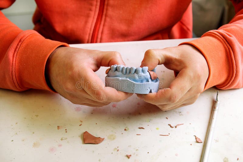 Pressing of Shellac Base Plates Over the Plaster Model Stock Photo ...